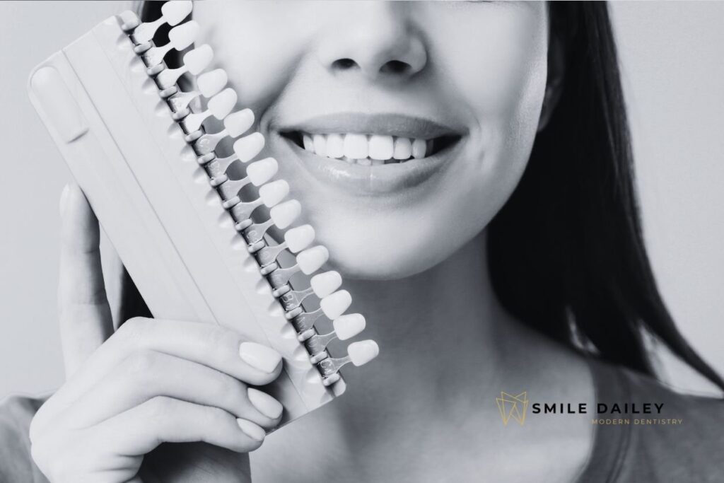 Veneers for Smile Makeover Explained